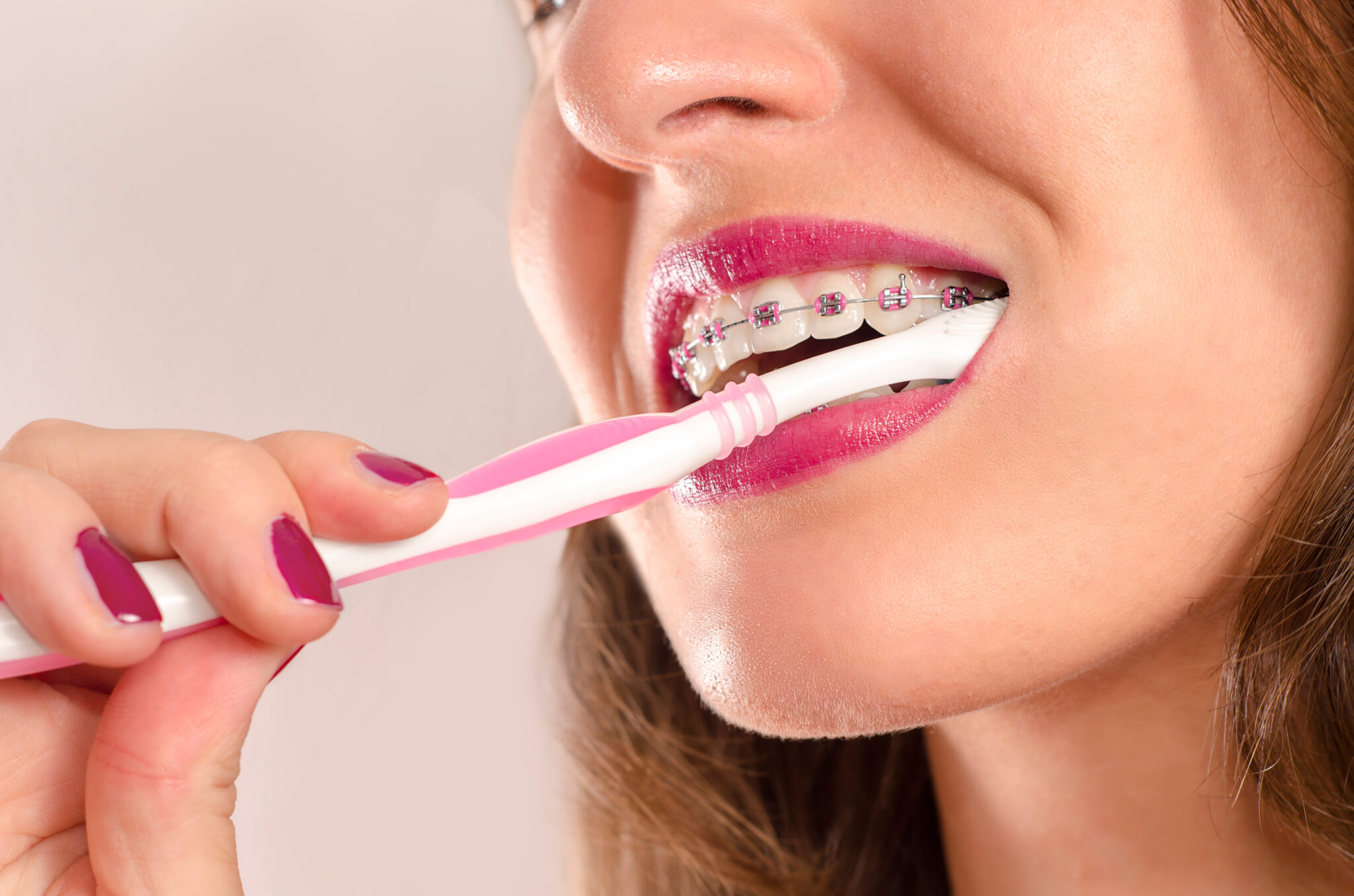 Is Pink a Good Color for Braces? - The Braces Guide